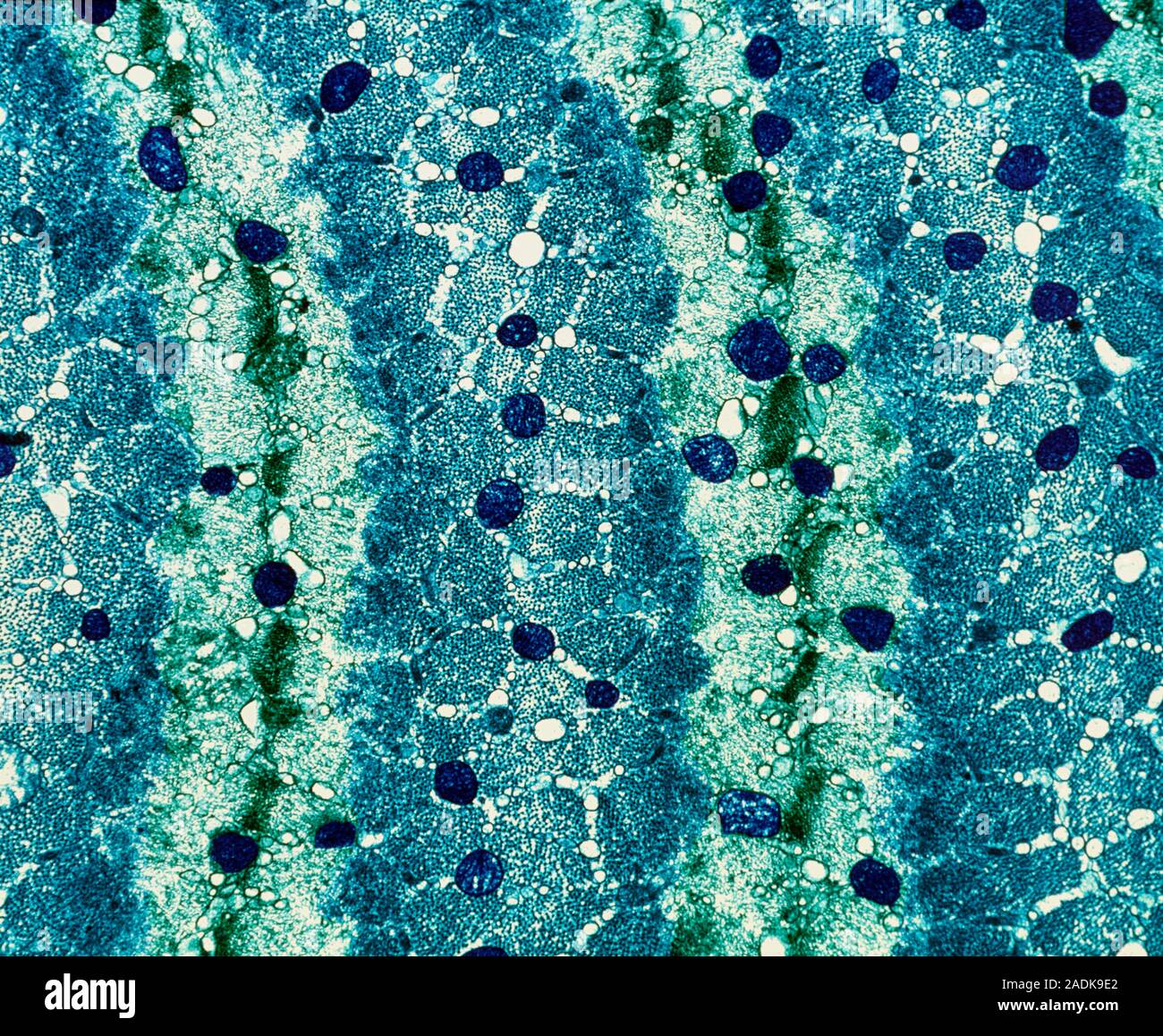 Skeletal muscle. Coloured transmission electron micrograph (TEM) of a transverse section through ...