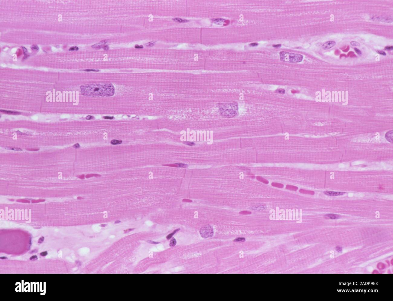 Cardiac muscle. Light micrograph of a longitudinal section through ...