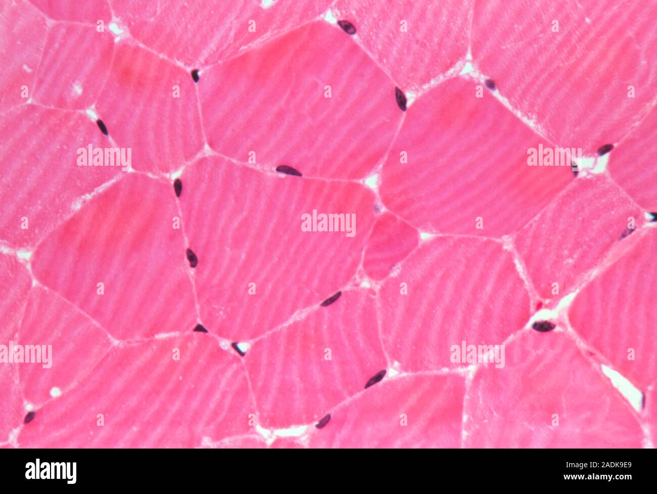 Skeletal muscle. Light micrograph of a transverse section through skeletal muscle fibres. This ...