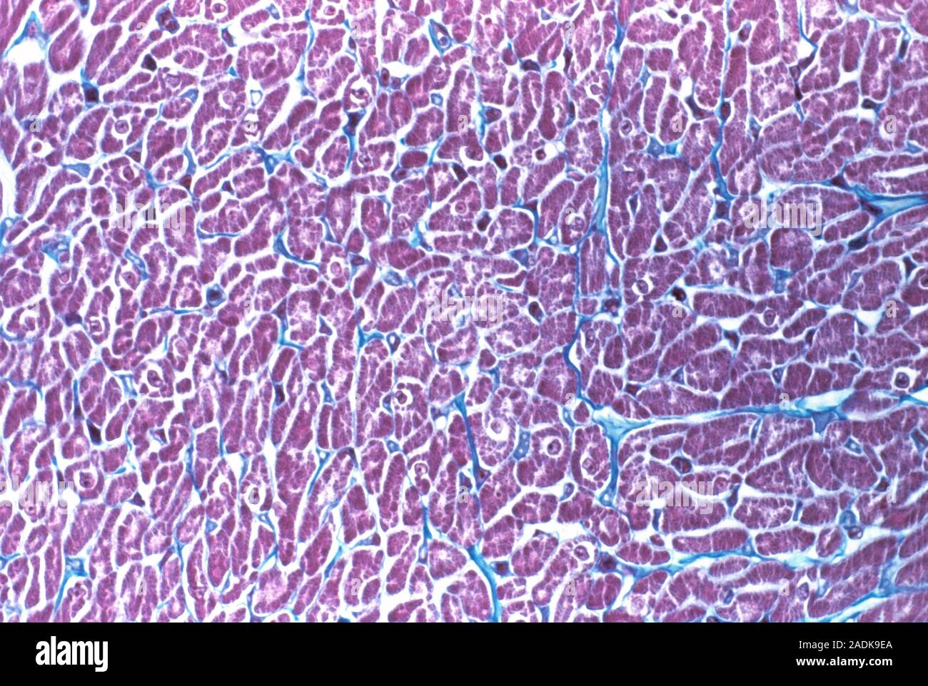 Cardiac Muscle Tissue Cross Section MUSCLE TISSUE | Basicmedical Key