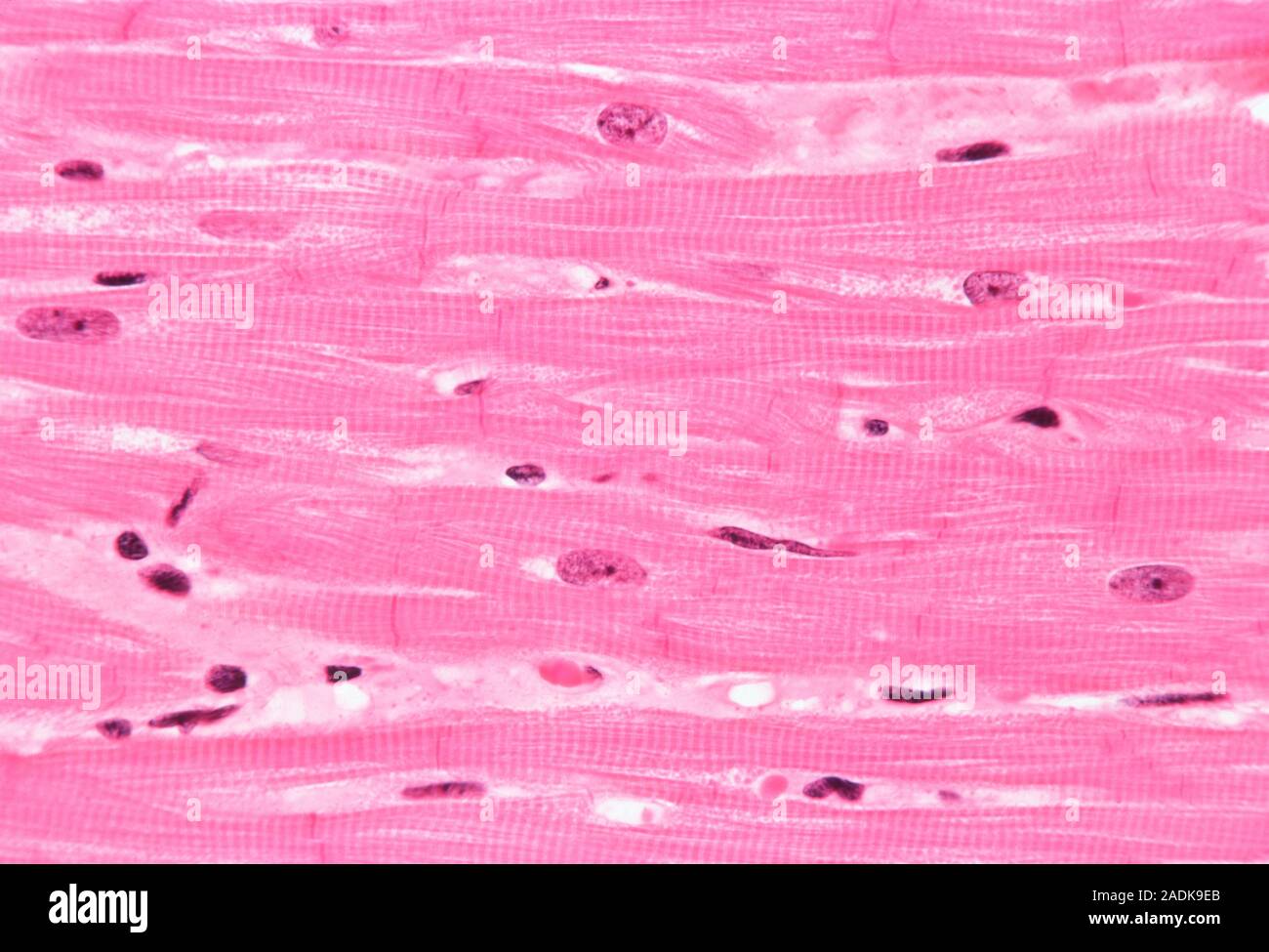 Cardiac muscle. Light micrograph of a longitudinal section through ...