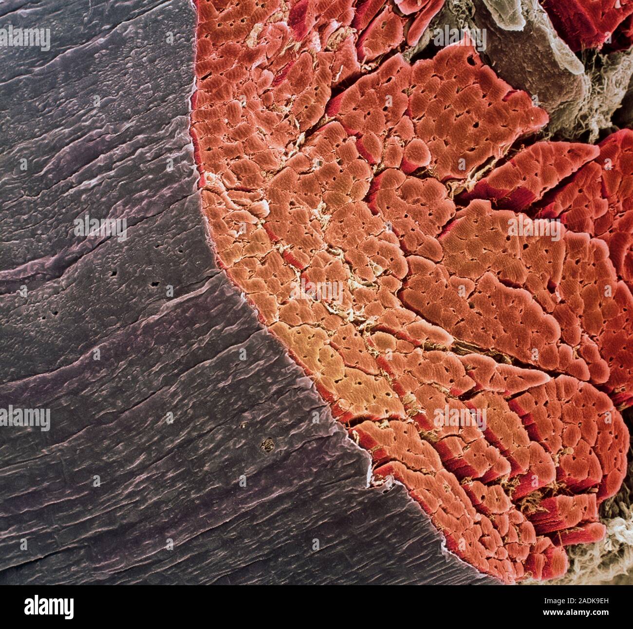 Skeletal muscle. Scanning electron micrograph (SEM) of a transverse section through skeletal ...