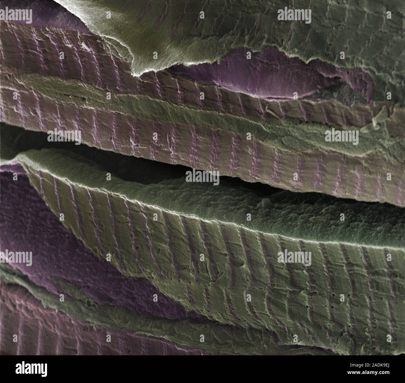 Cardiac muscle. Coloured scanning electron micrograph (SEM) of a freeze-fractured section ...