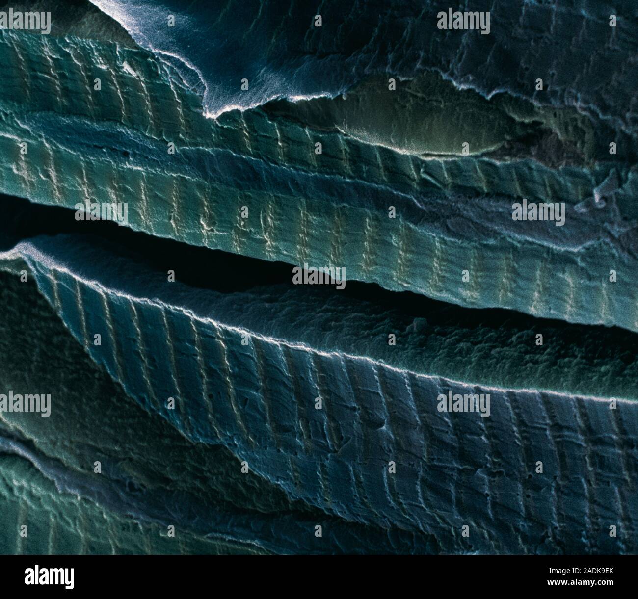 Cardiac muscle. Coloured scanning electron micrograph (SEM) of a freeze-fractured section ...