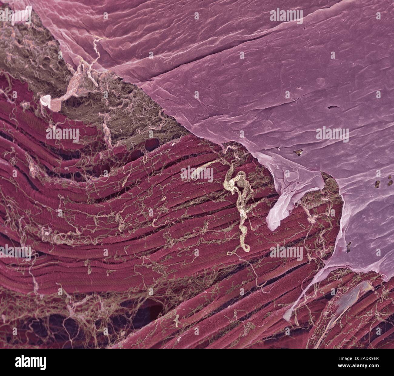 Skeletal muscle. Coloured scanning electron micrograph (SEM) of a bundle of skeletal muscle ...