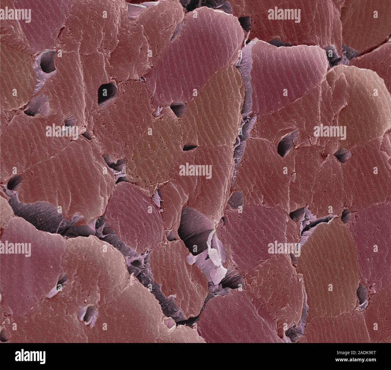Skeletal muscle. Coloured scanning electron micrograph (SEM) of a freeze-fractured transverse ...