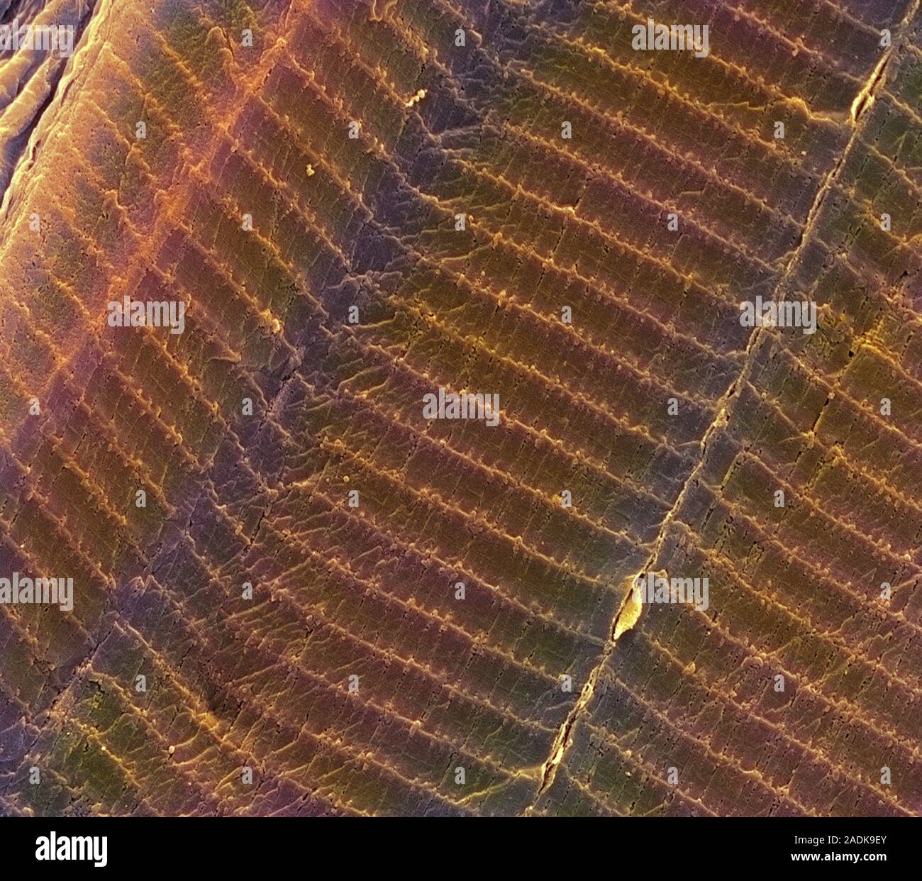 Striated muscle. Coloured scanning electron micrograph (SEM) of a freeze-fractured striated, or ...