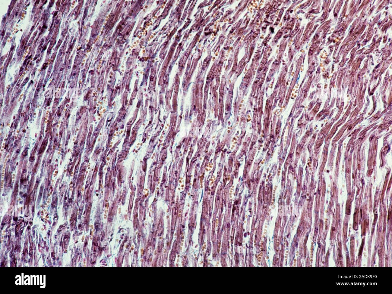 Heart muscle. Light micrograph of a longitudinal section through ...