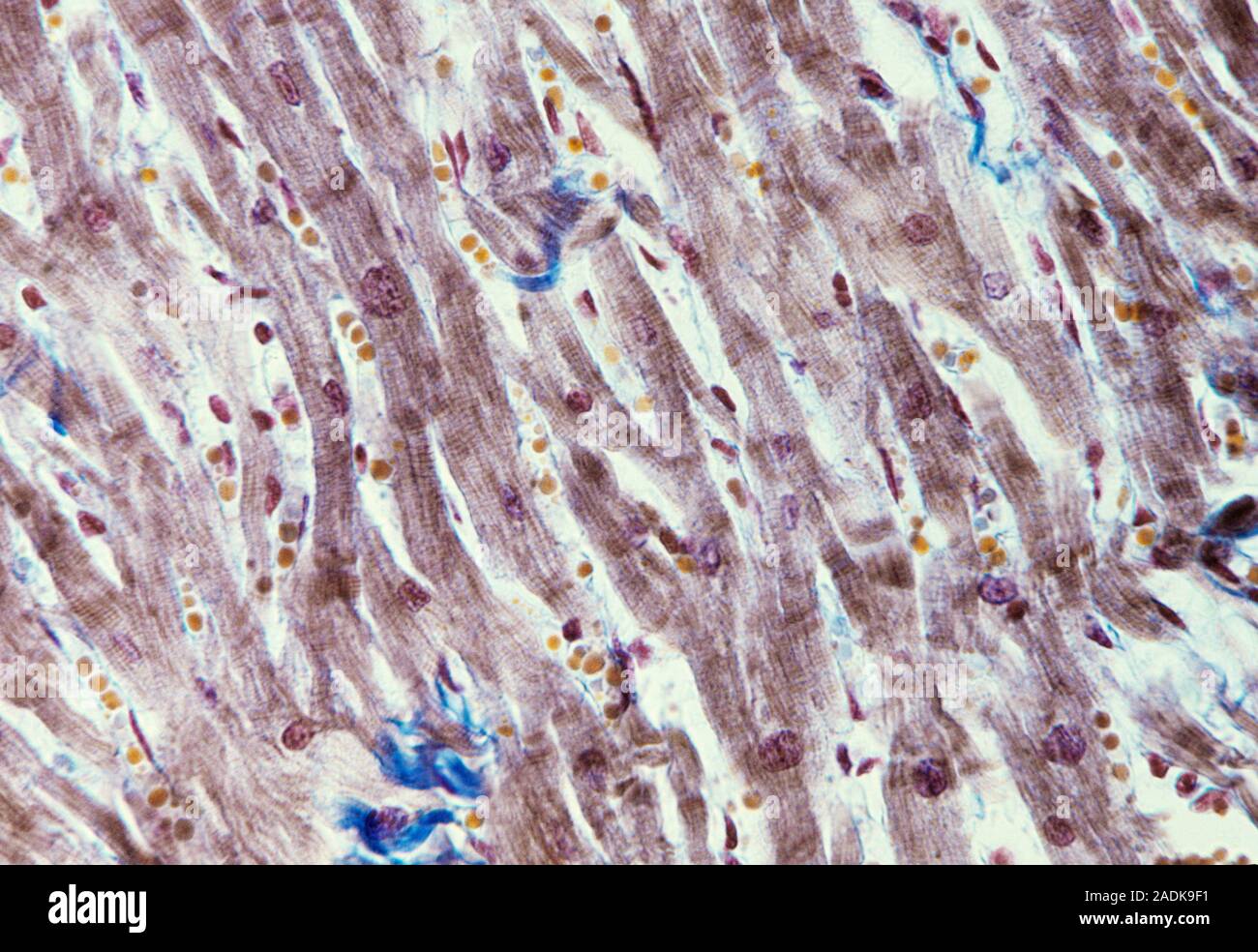 Heart muscle. Light micrograph of a longitudinal section through ...