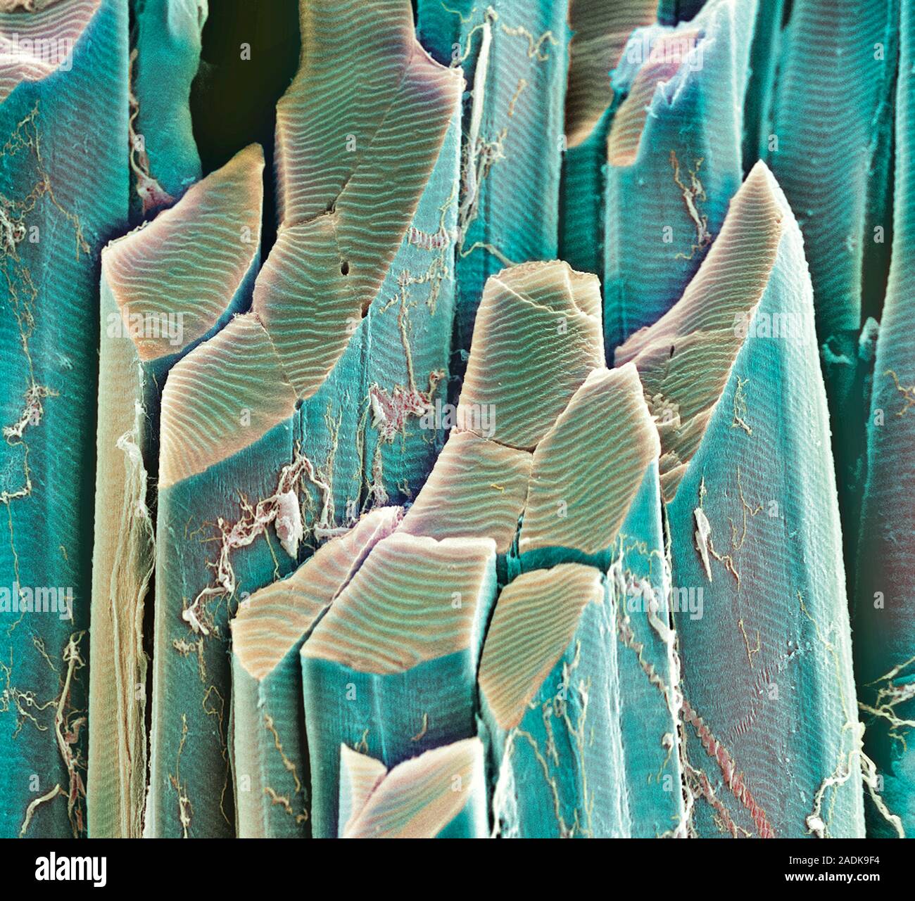 Skeletal muscle fibres. Coloured scanning electron micrograph (SEM) of a freeze-fractured bundle ...