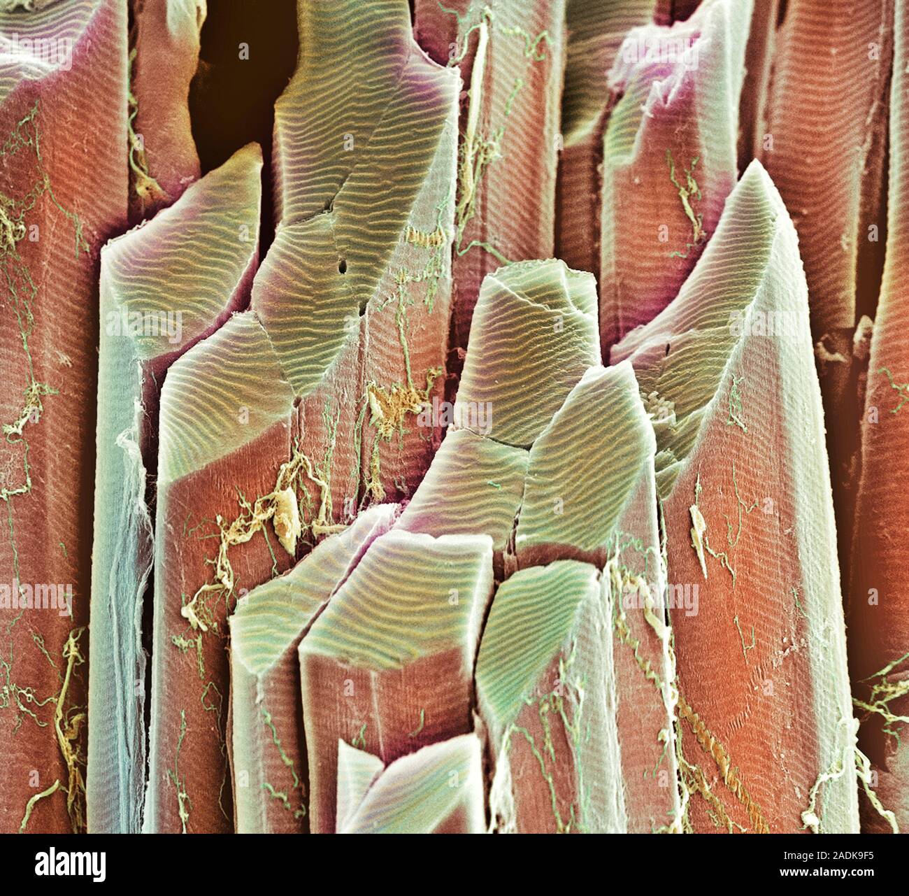 Skeletal muscle fibres. Coloured scanning electron micrograph (SEM) of a freeze-fractured bundle ...