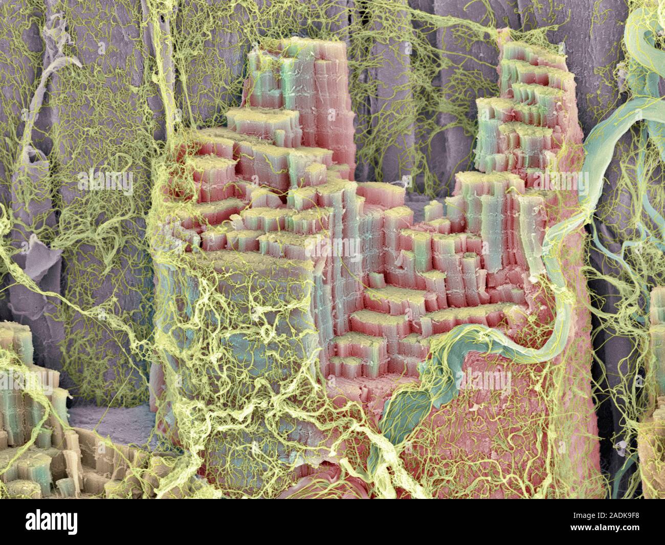 Skeletal muscle fibre. Coloured scanning electron micrograph (SEM) of a freeze-fractured ...