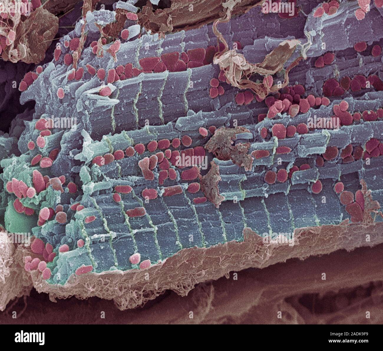 Cardiac muscle. Coloured scanning electron micrograph (SEM) of healthy ...