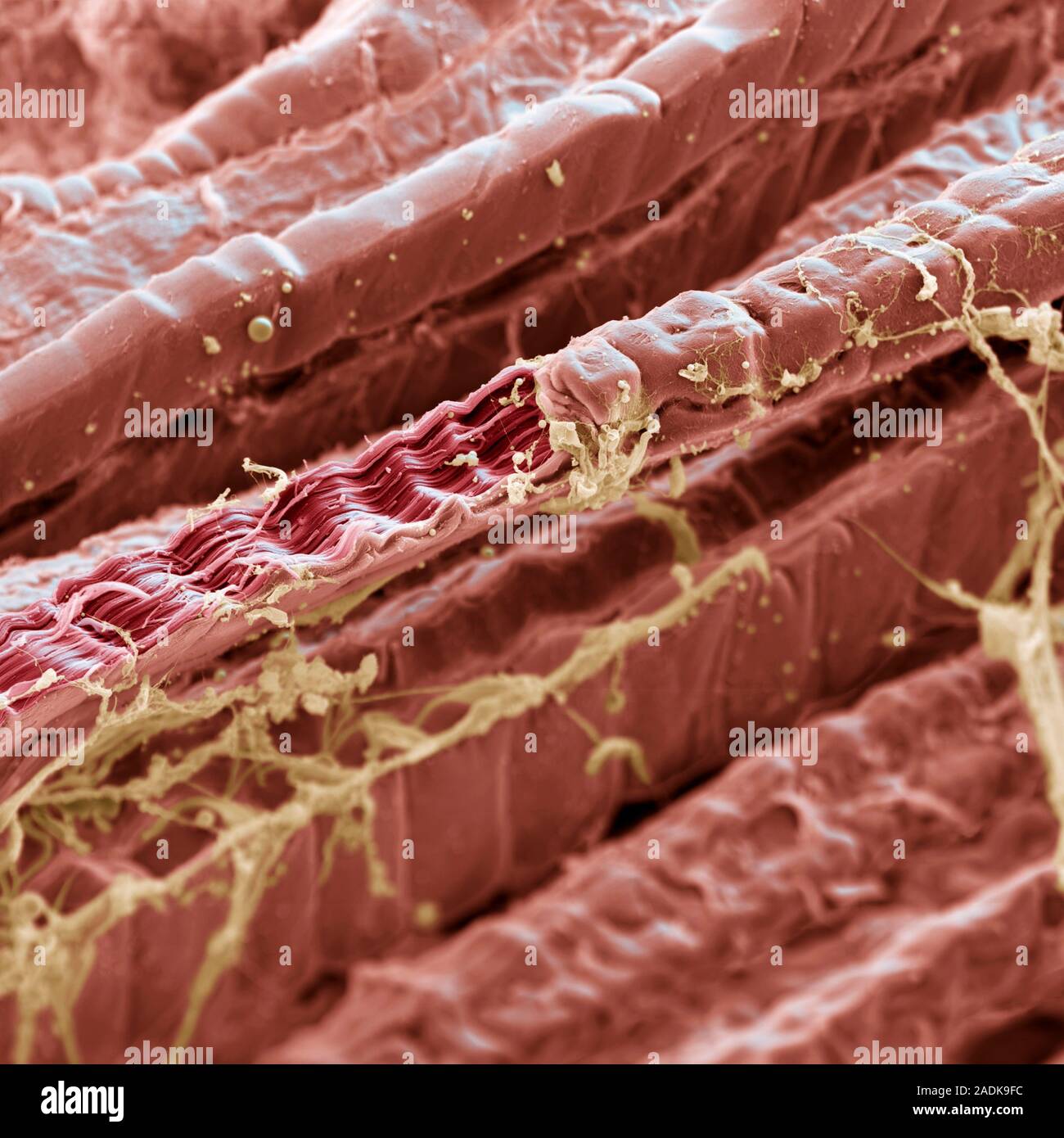 Skeletal muscle. Coloured scanning electron micrograph (SEM) of skeletal (striated) muscle. The ...