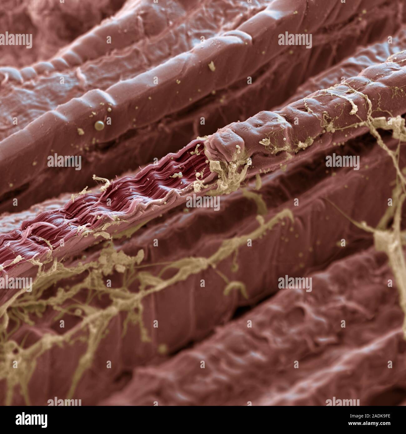 Skeletal muscle. Coloured scanning electron micrograph (SEM) of skeletal (striated) muscle. The ...