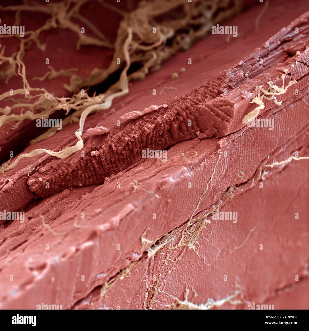 Skeletal muscle. Coloured scanning electron micrograph (SEM) of skeletal (striated) muscle. The ...