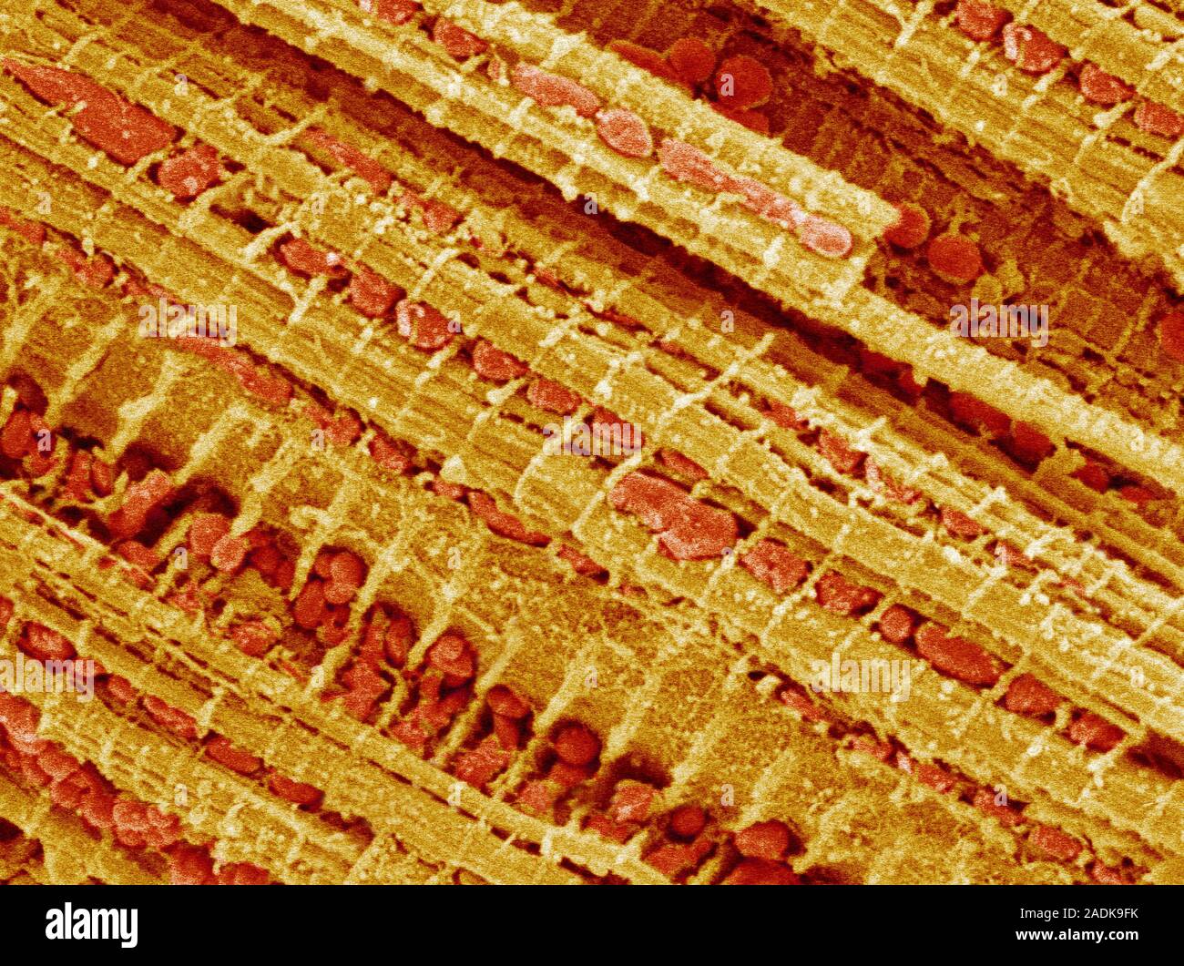 Cardiac muscle. Coloured scanning electron micrograph (SEM) of healthy ...