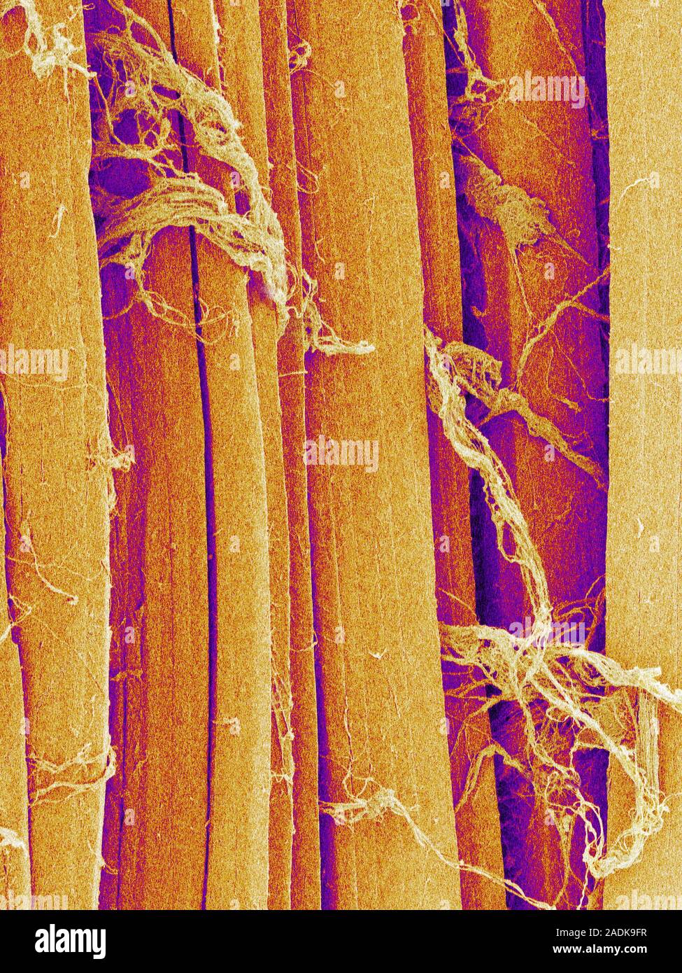 Skeletal muscle fibre. Coloured scanning electron micrograph (SEM) of skeletal muscle fibre ...