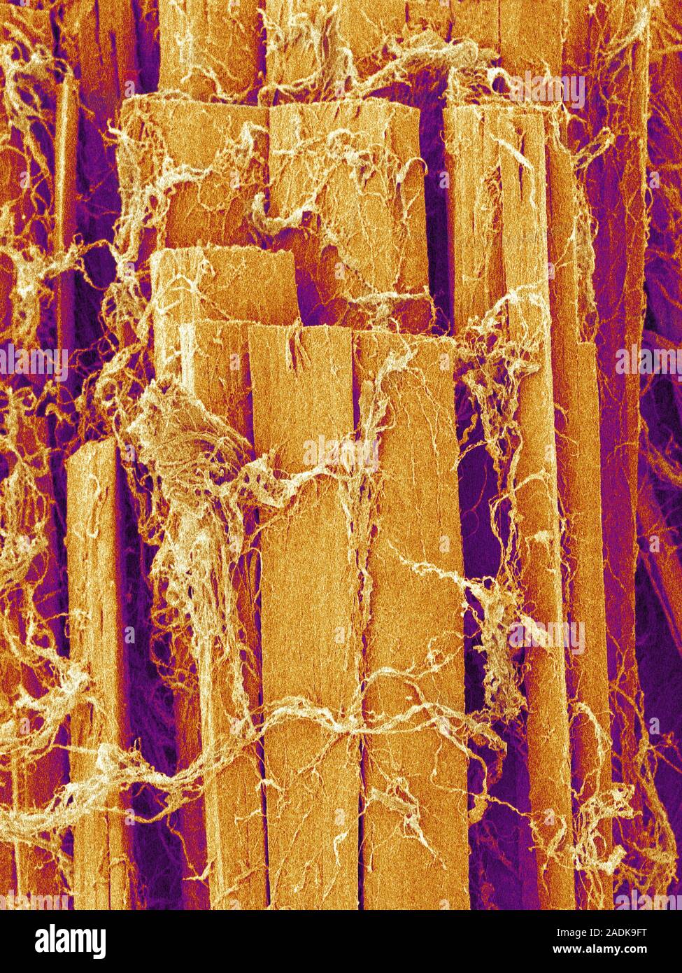 Skeletal muscle fibre. Coloured scanning electron micrograph (SEM) of skeletal muscle fibre ...