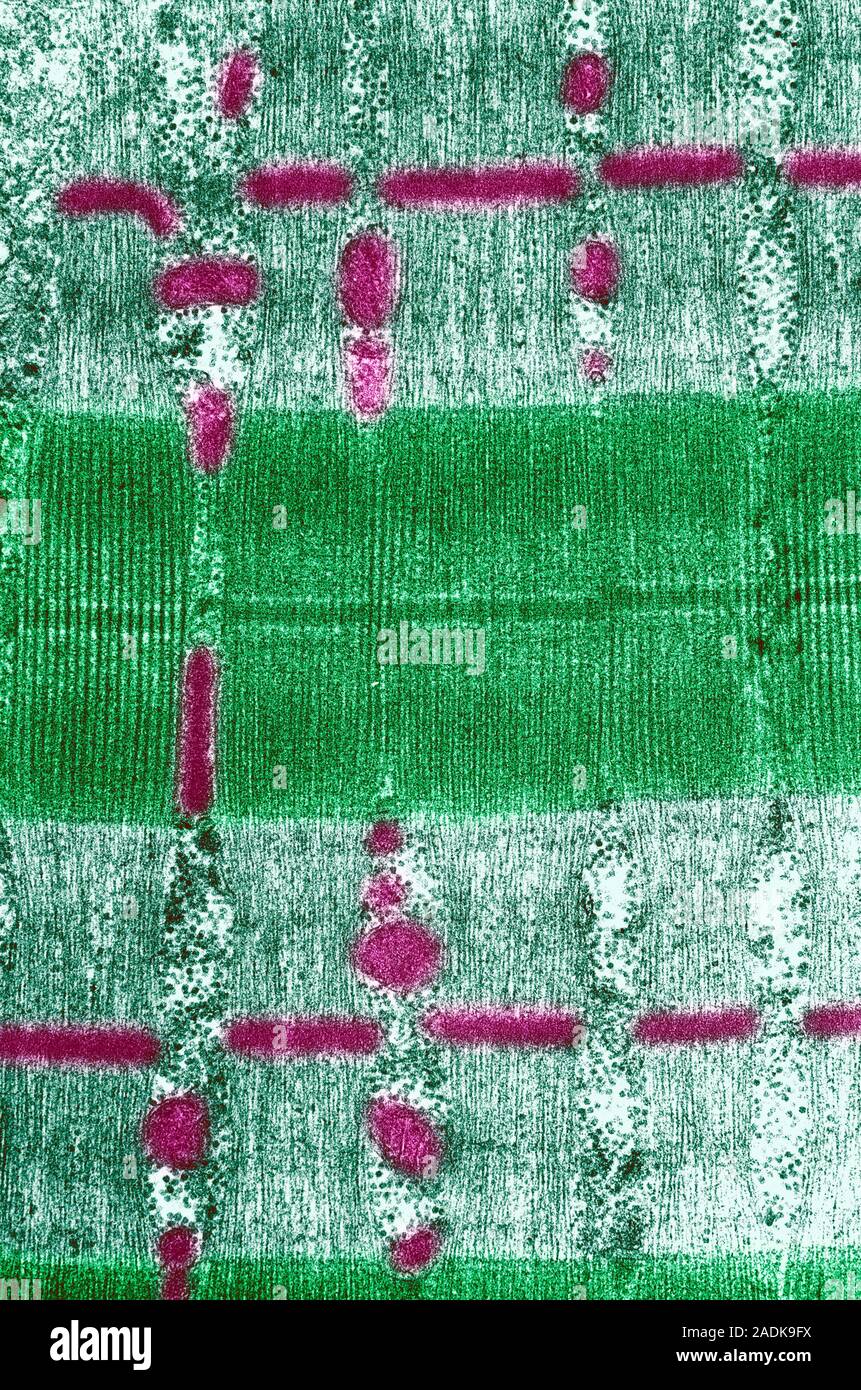 Striated muscle. Coloured transmission electron micrograph (TEM) of a longitudinal section ...