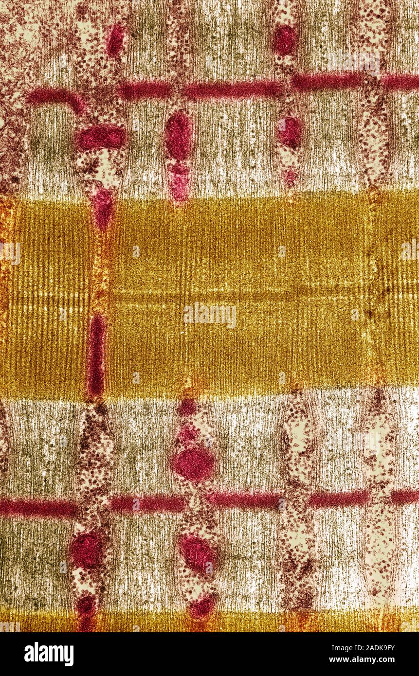 Striated muscle. Coloured transmission electron micrograph (TEM) of a longitudinal section ...