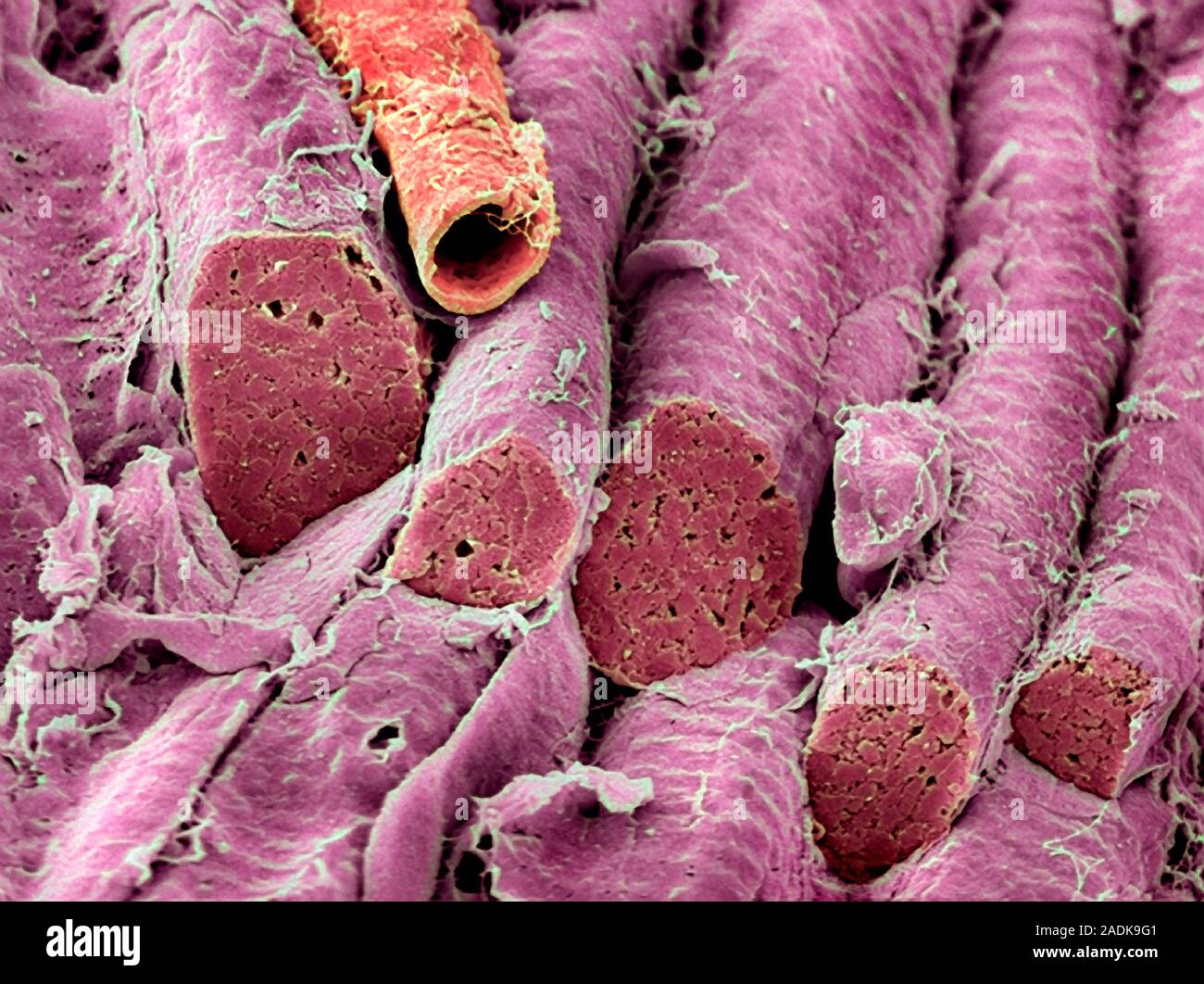 Smooth muscle fibres. Coloured scanning electron micrograph (SEM) of a freeze-fractured bundle ...
