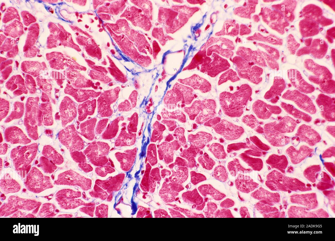 Heart muscle. Light micrograph of a transverse section through cardiac ...