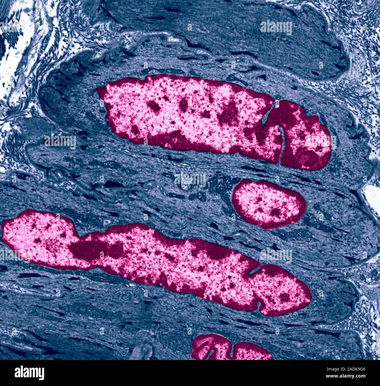 Gut muscle cells, coloured transmission electron micrograph (TEM ...