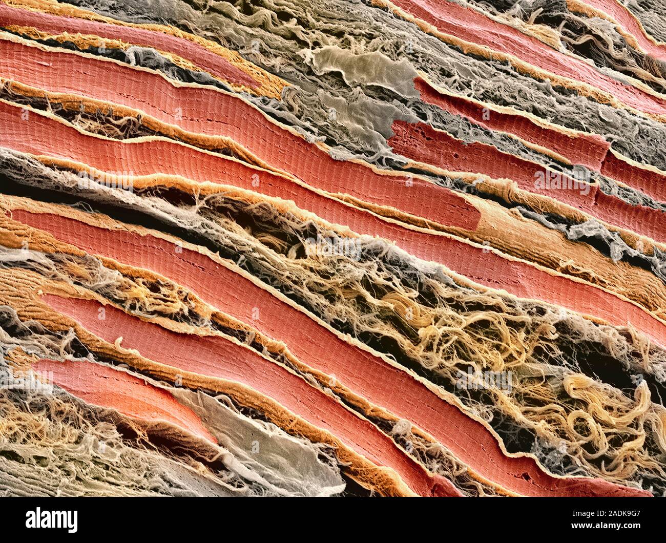 Skeletal muscle. Coloured scanning electron micrograph (SEM) of skeletal muscle fibres that have ...