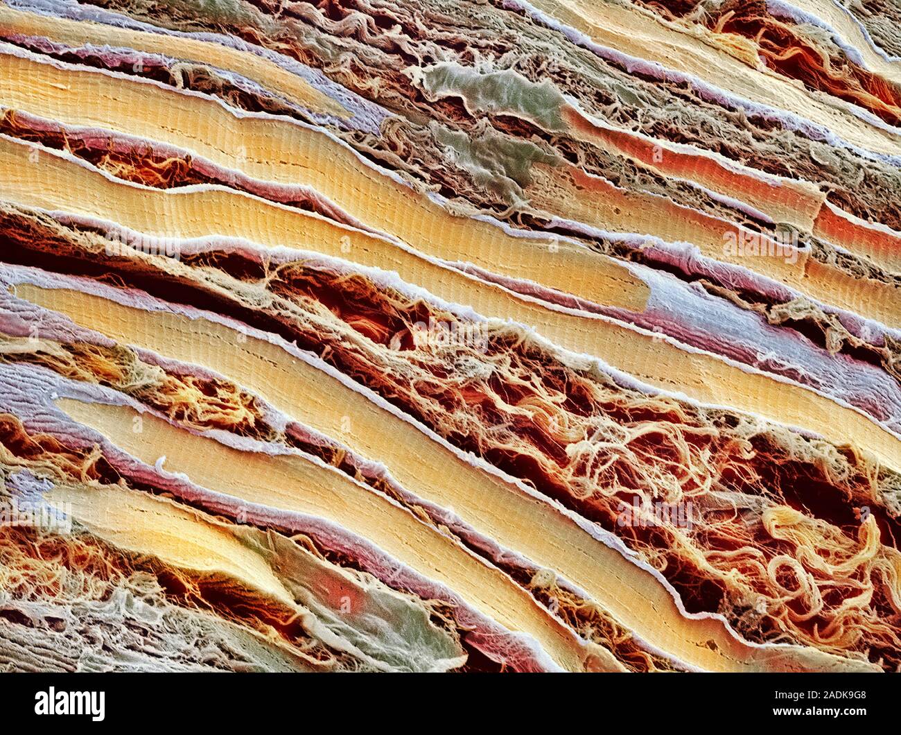 Skeletal muscle. Coloured scanning electron micrograph (SEM) of skeletal muscle fibres that have ...