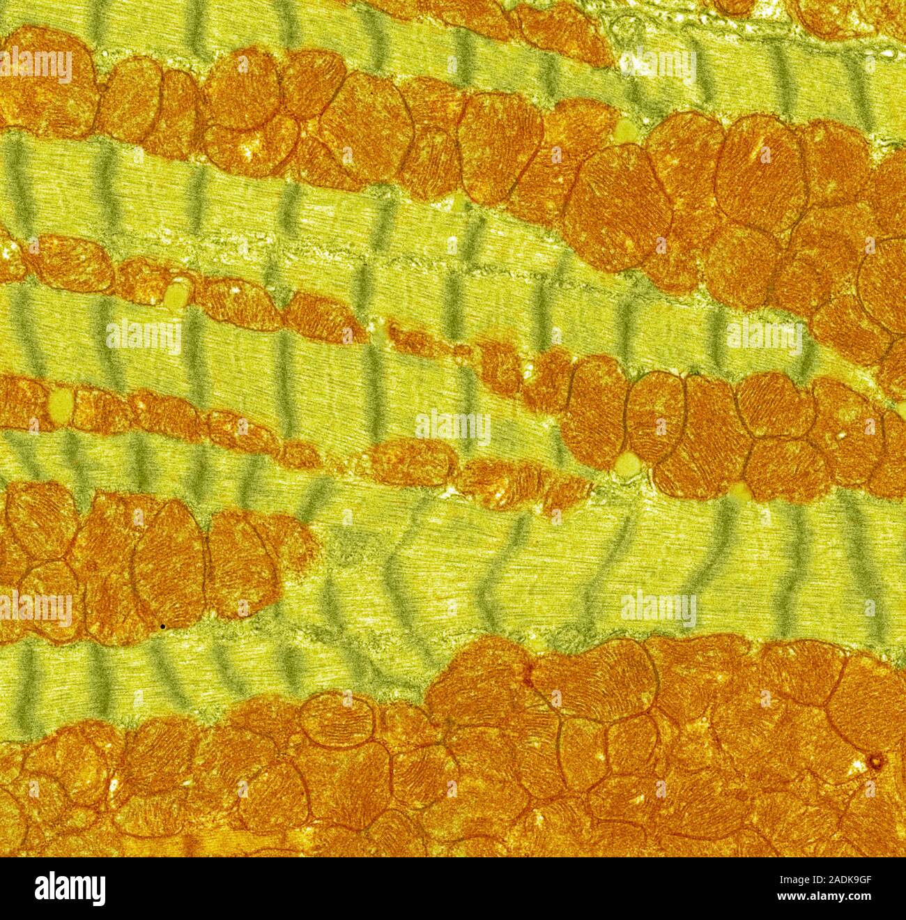 Cardiac muscle. Coloured transmission electron micrograph (TEM) of cardiac muscle fibrils ...