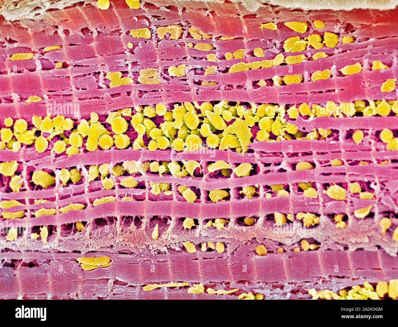 Cardiac muscle. Coloured scanning electron micrograph (SEM) of cardiac ...