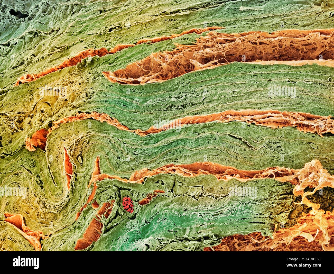 Cardiac muscle. Coloured scanning electron micrograph (SEM) of cardiac ...