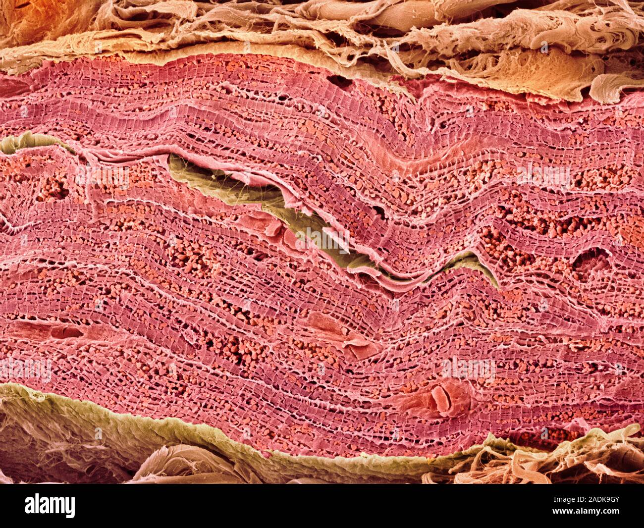 Cardiac muscle. Coloured scanning electron micrograph (SEM) of a bundle ...