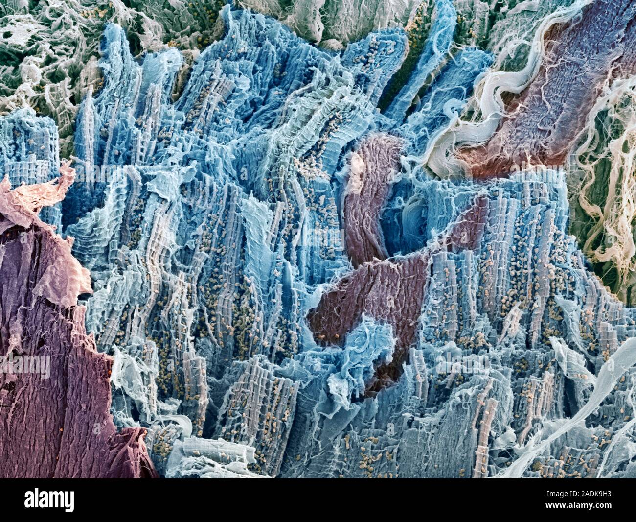 Cardiac muscle. Coloured scanning electron micrograph (SEM) of cardiac ...
