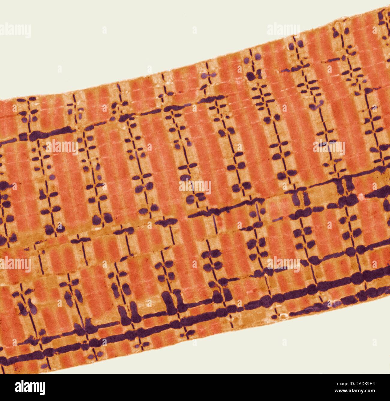 Skeletal muscle. Coloured transmission electron micrograph (TEM) of a ...