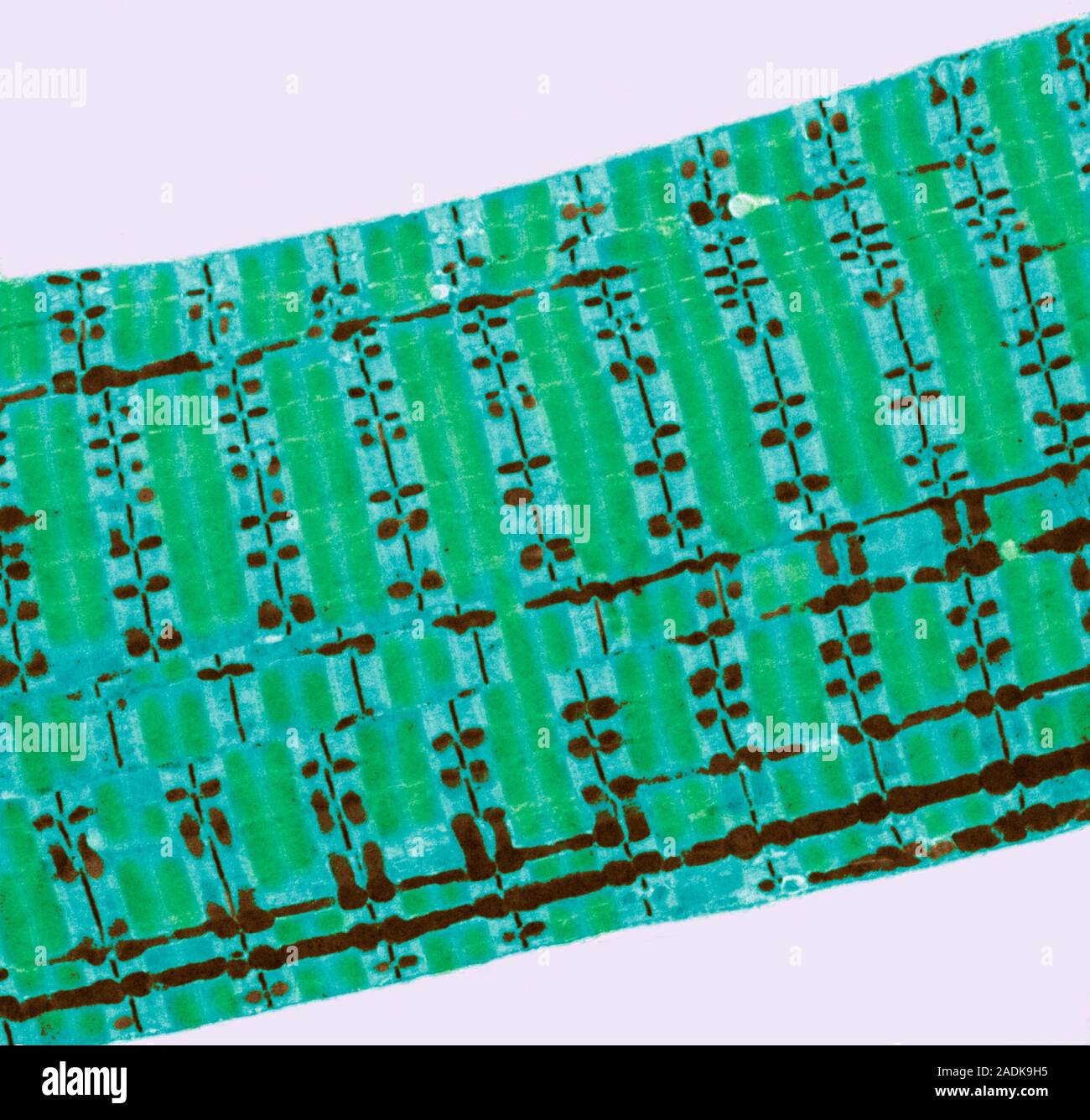 Skeletal muscle. Coloured transmission electron micrograph (TEM) of a longitudinal section ...