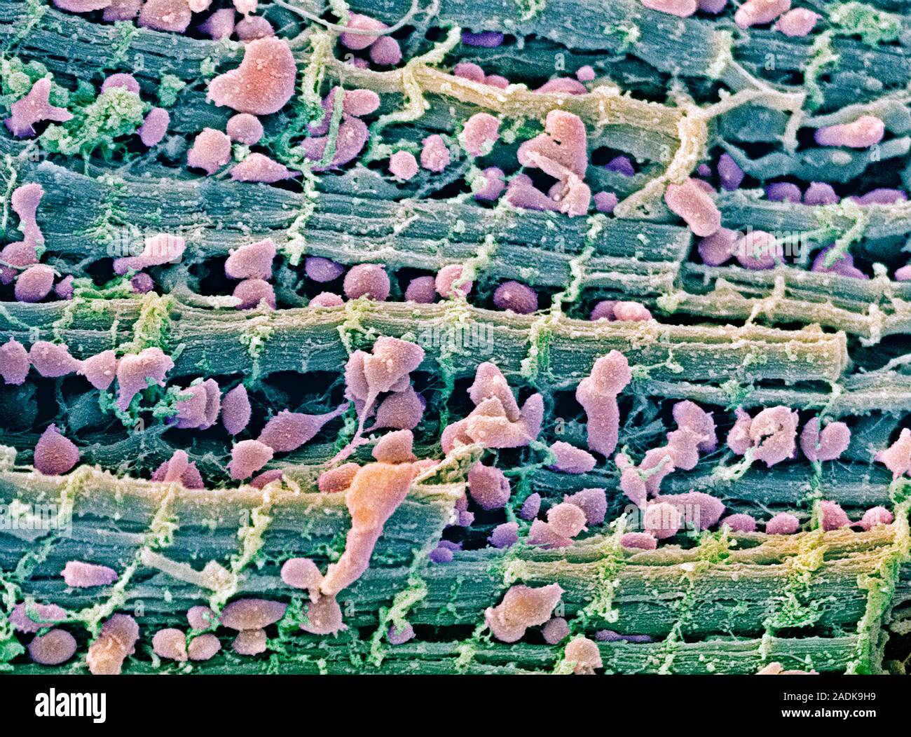 Cardiac muscle. Coloured scanning electron micrograph (SEM) of cardiac ...