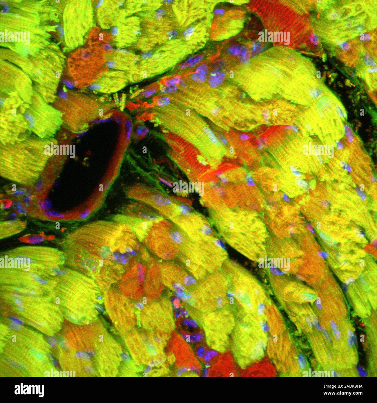 Heart muscle. Confocal light micrograph of a section through cardiac ...