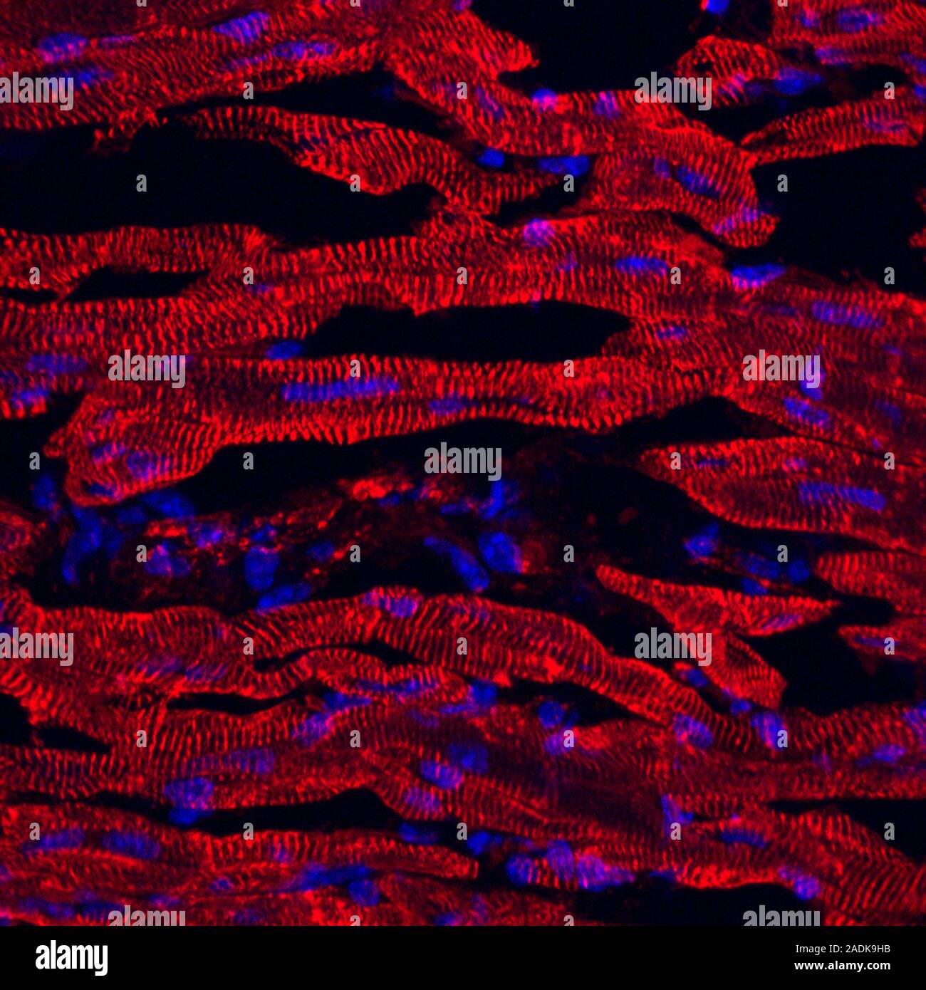 Heart muscle. Confocal light micrograph of a section through cardiac ...