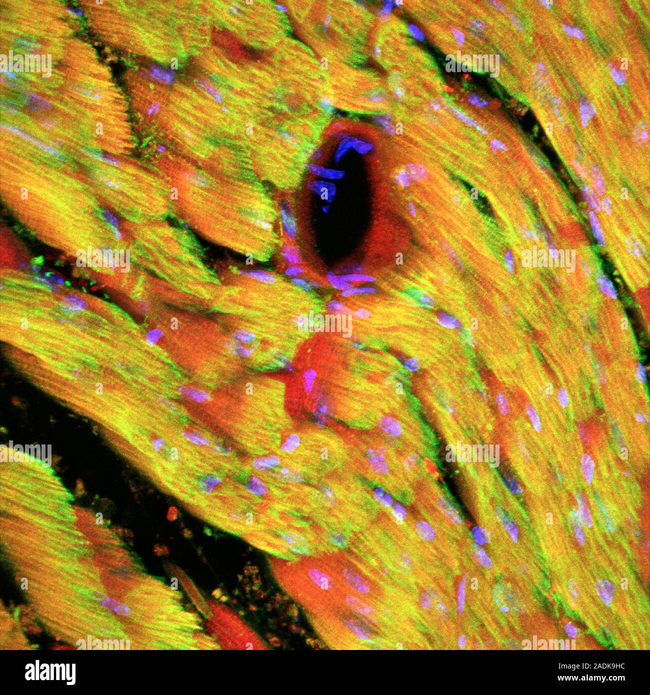 Heart muscle. Confocal light micrograph of a section through cardiac ...