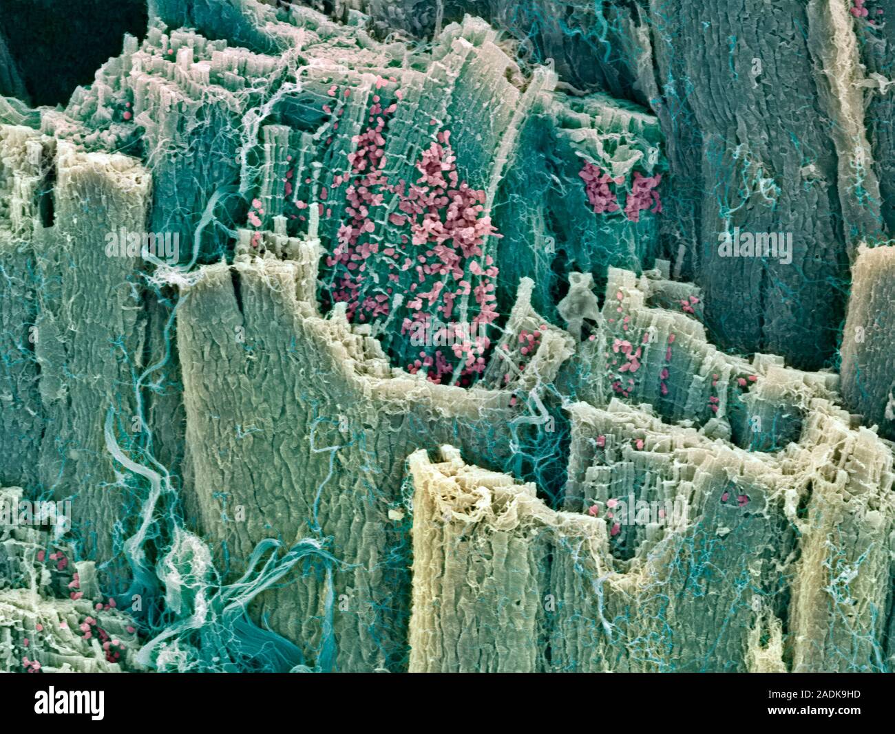 Cardiac muscle. Coloured scanning electron micrograph (SEM) of a freeze ...