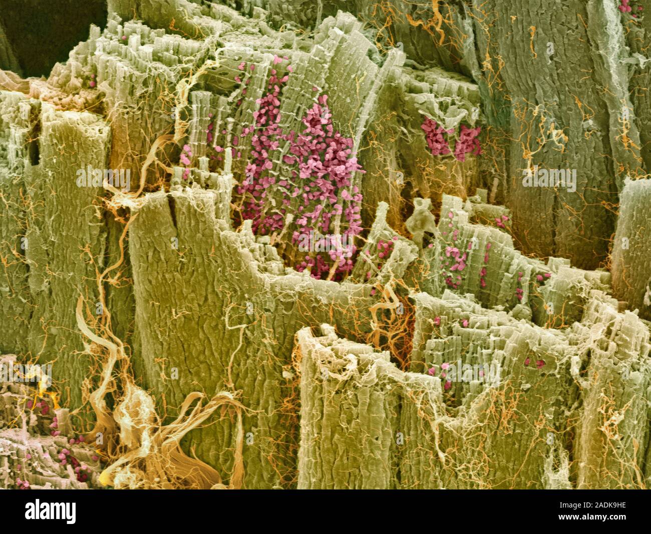 Cardiac muscle. Coloured scanning electron micrograph (SEM) of a freeze ...
