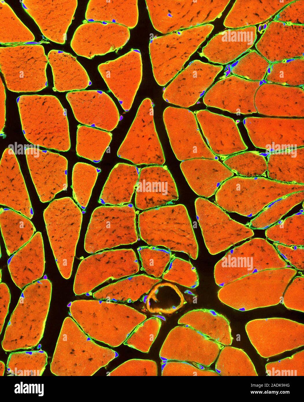 Skeletal muscle. Confocal fluorescent light micrograph of a section ...