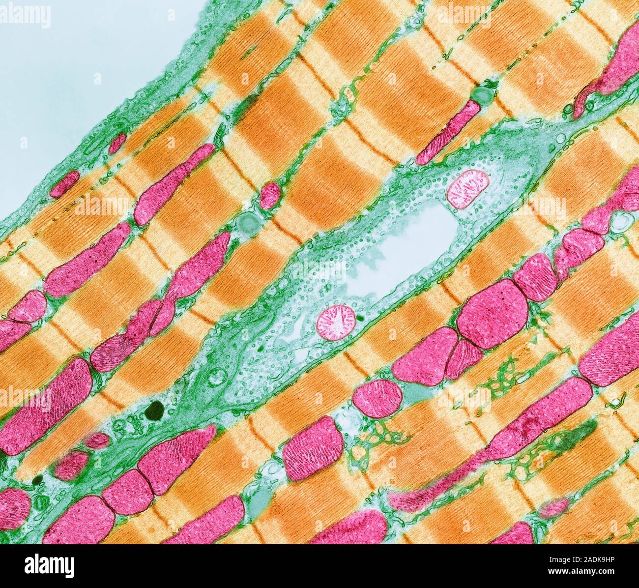 Cardiac muscle. Coloured transmission electron micrograph (TEM) of cardiac muscle fibrils ...
