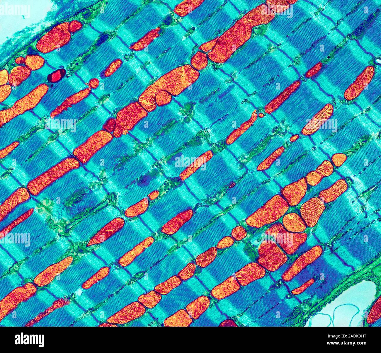 Cardiac muscle. Coloured transmission electron micrograph (TEM) of ...