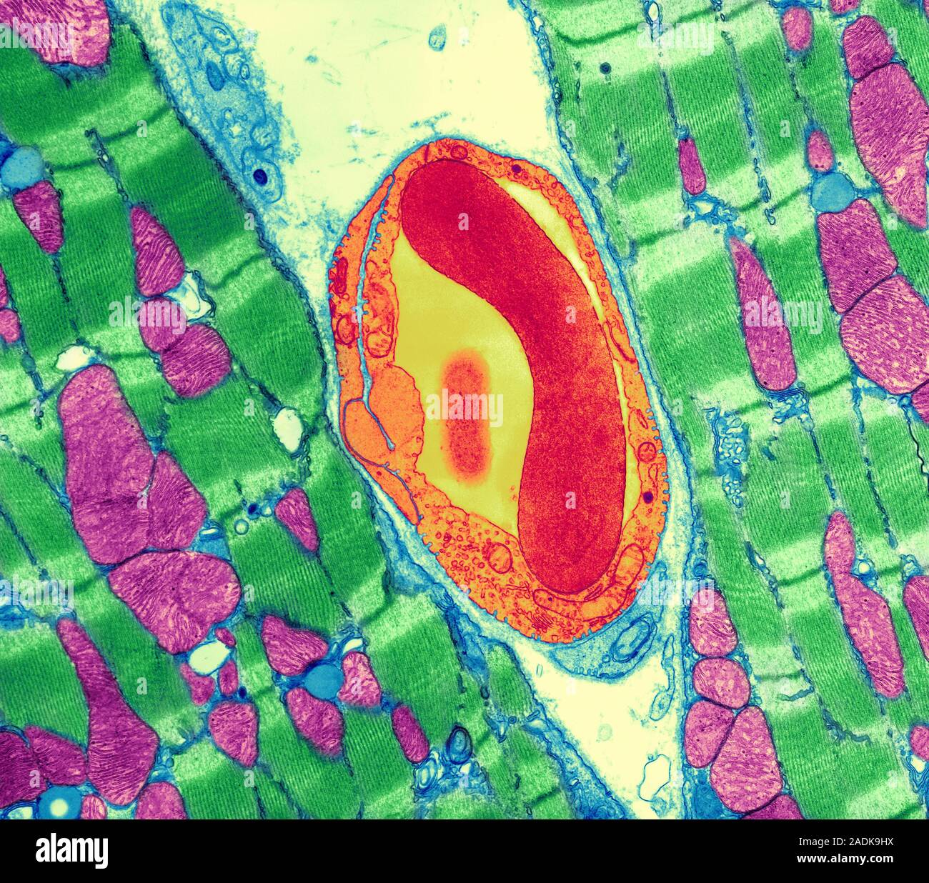 Cardiac muscle. Coloured transmission electron micrograph (TEM) of ...