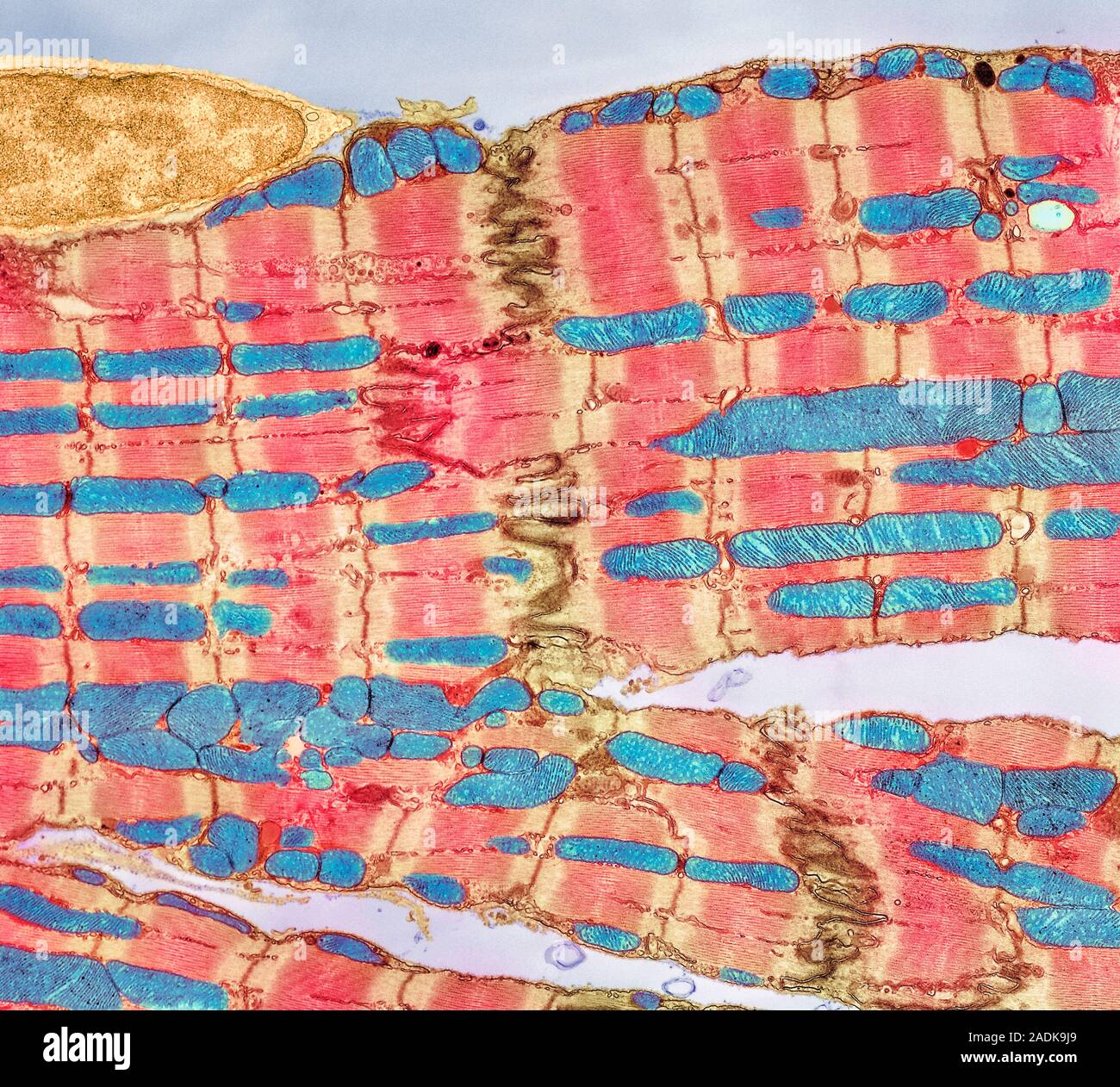 Cardiac muscle. Coloured transmission electron micrograph (TEM) of ...