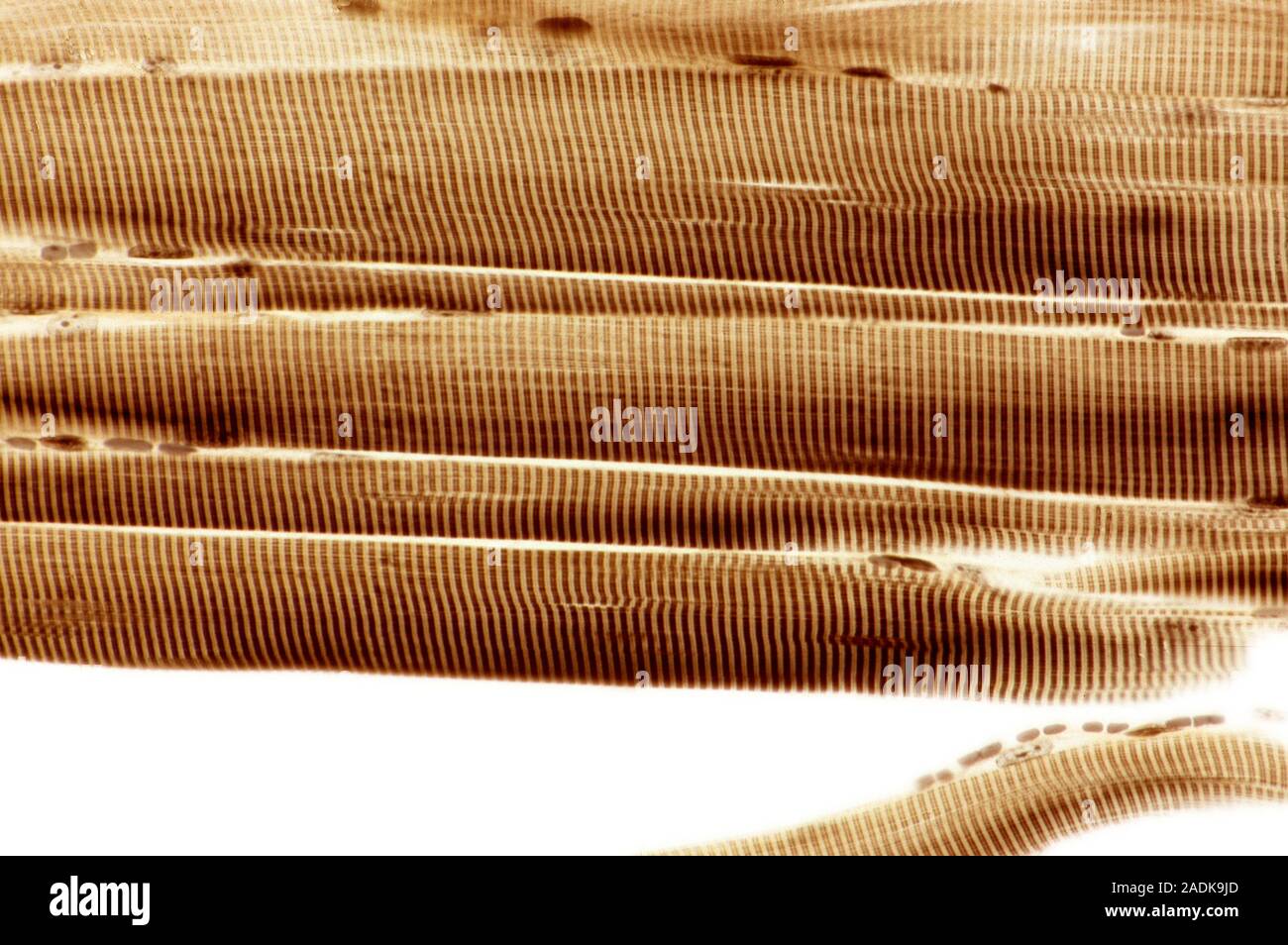 Skeletal muscle fibres. Light micrograph of a longitudinal section ...