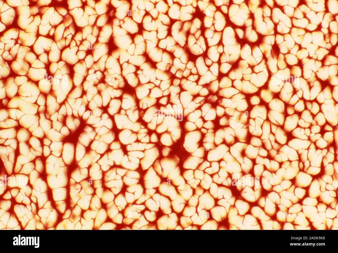 Tendon. Light micrograph of a cross section through normal human tendon ...